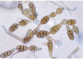 O Que são Fungos Demáceos? E Os Dimórficos? – Mundo Ecologia