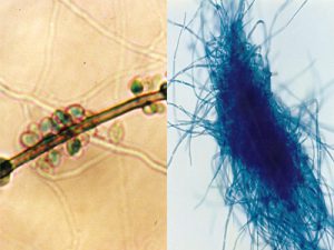 O Que São os Fungos Filamentosos? Para que Servem? | Mundo Ecologia