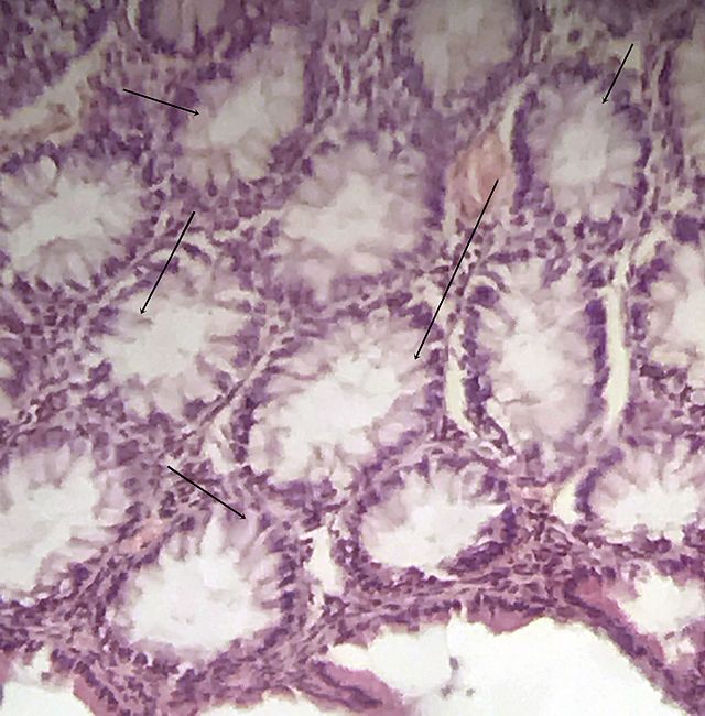 O Que São Cílios e Células Caliciformes e Quais Suas Funções? – Mundo ...