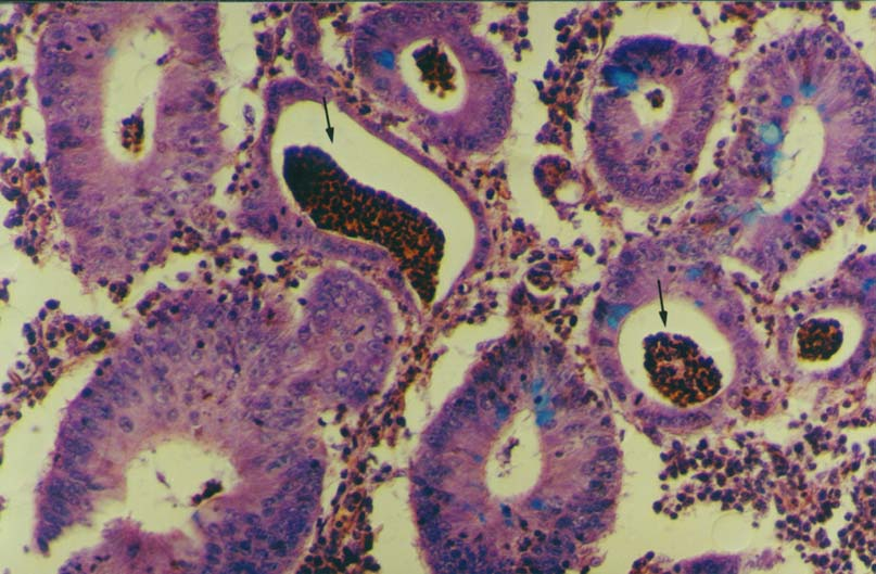 O Que São Cílios e Células Caliciformes e Quais Suas Funções? – Mundo ...