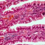 O Que São Cílios e Células Caliciformes e Quais Suas Funções? | Mundo ...