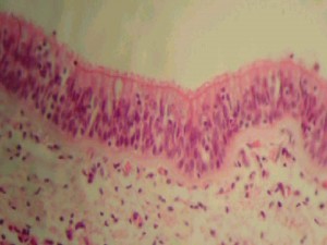 O Que São Cílios e Células Caliciformes e Quais Suas Funções? – Mundo ...