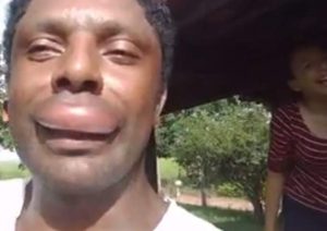 Como Curar a Picada de Marimbondo? O Que Fazer? | Mundo Ecologia